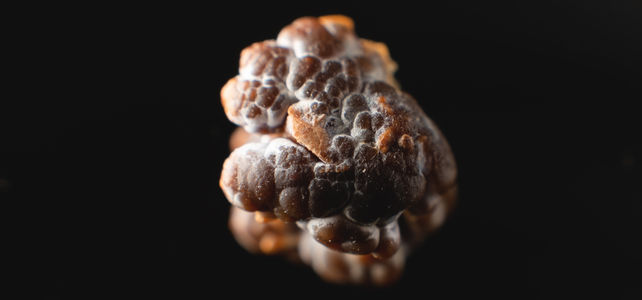 Die schmerzhafte Geschichte der Harnsteine und ihrer Behandlung